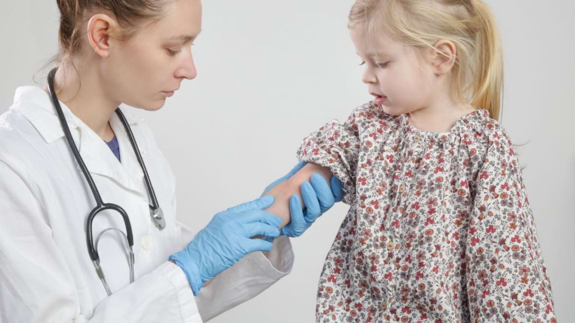 Psoriazisul la copii: cauze, simptome, tratament