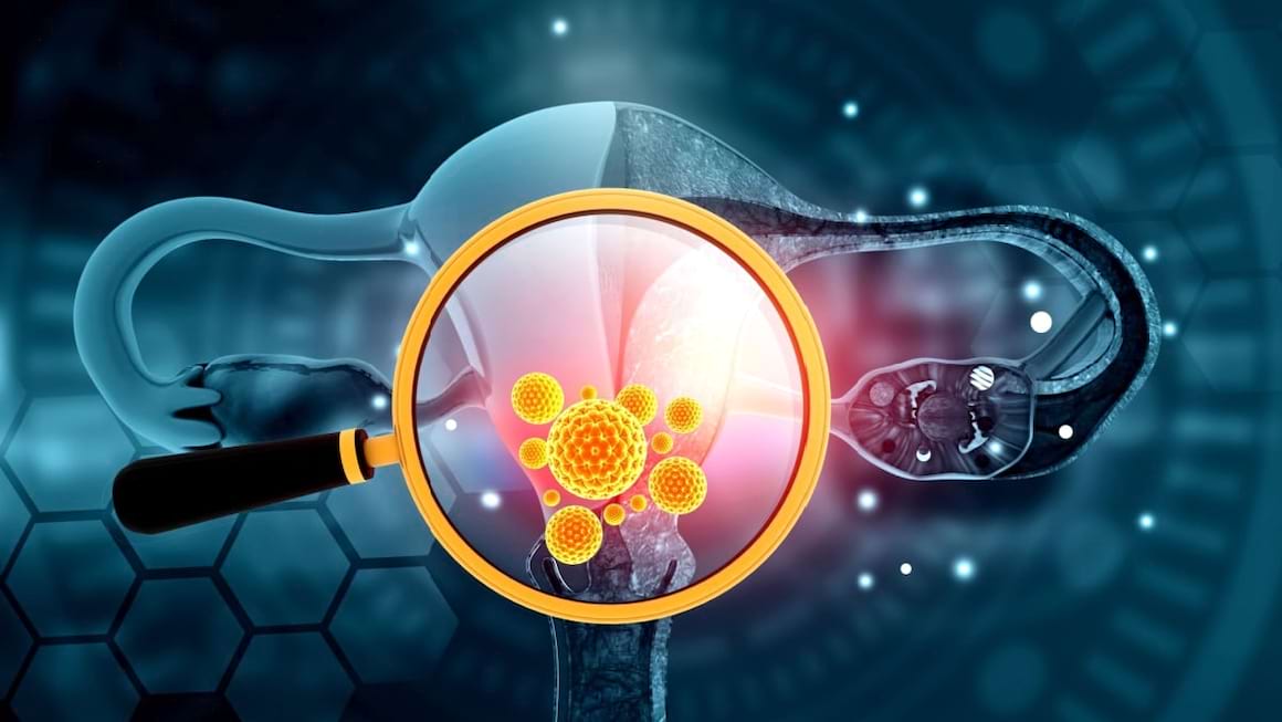 Infectia cu trichomonas: cum se manifesta si cum se vindeca