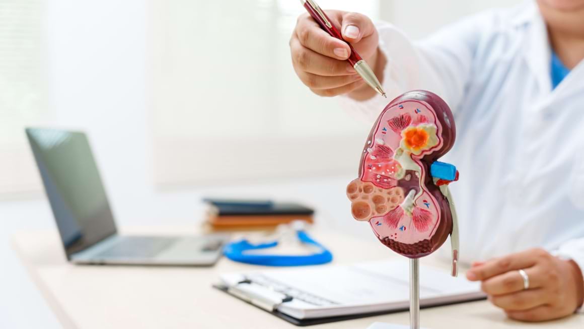 Tratamente eficiente pentru pietre la rinichi