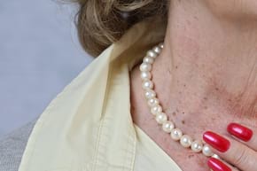 Veruca plantară sau negi în talpă: cum se manifestă și ce tratament există