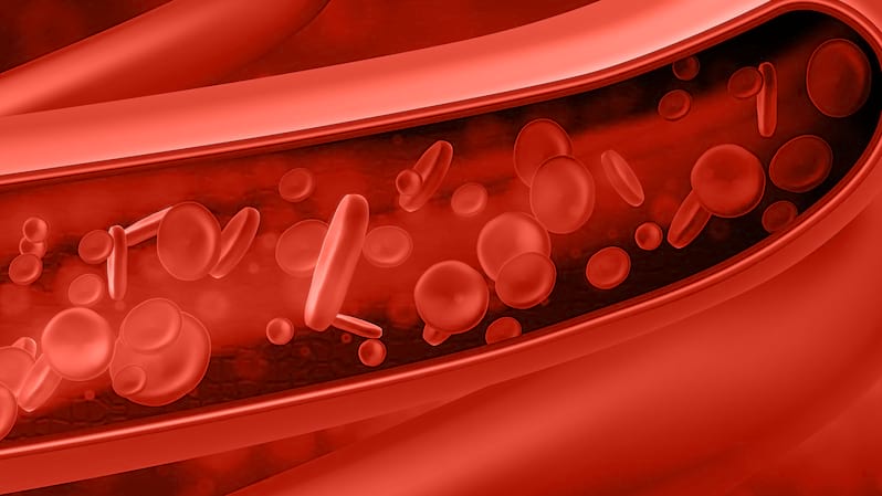 Lupus eritematos sistemic: cauze, simptome si tratament