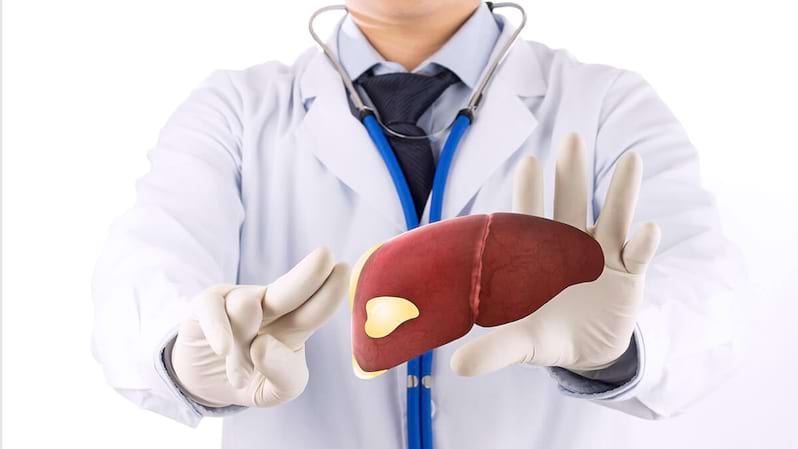 Steatoza hepatică sau ficatul gras