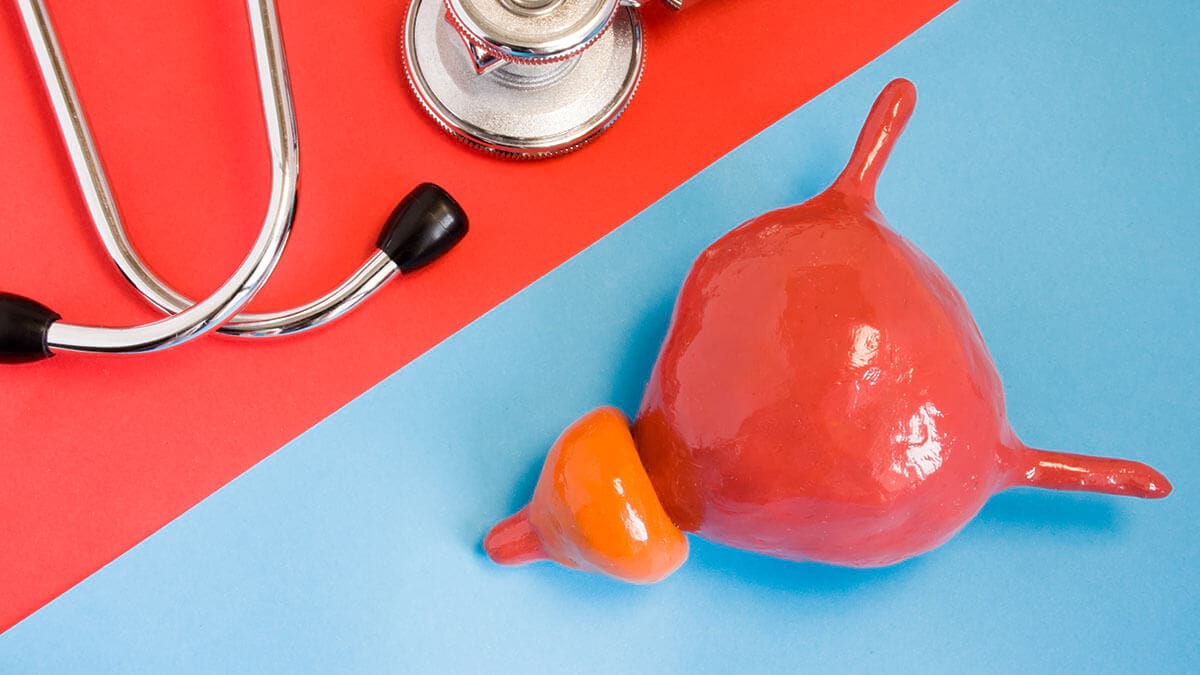 Cancerul de prostata: Simptome, Cauze, Tratament - Doc.ro