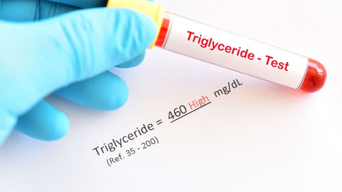 Trigliceride serice marite (crescute)