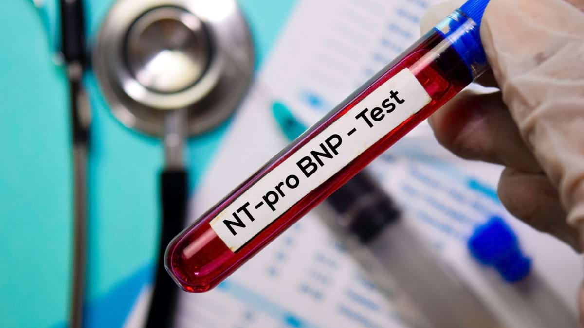 Analiza NT-proBNP: ce este, ce indică și cum te pregătești?