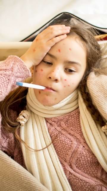 Rujeola sau Pojarul la copii - Transmitere, Simptome, Complicatii