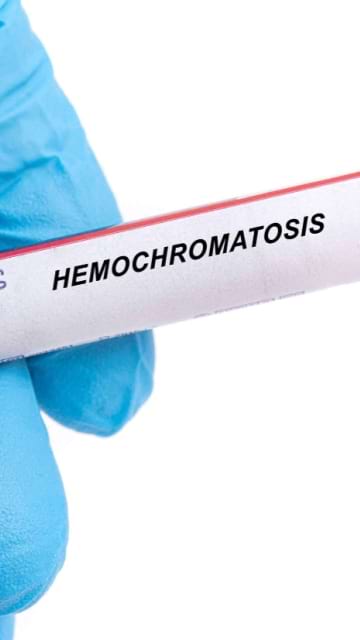 Hemocromatoza sau excesul de fier in organism: simptome si solutii